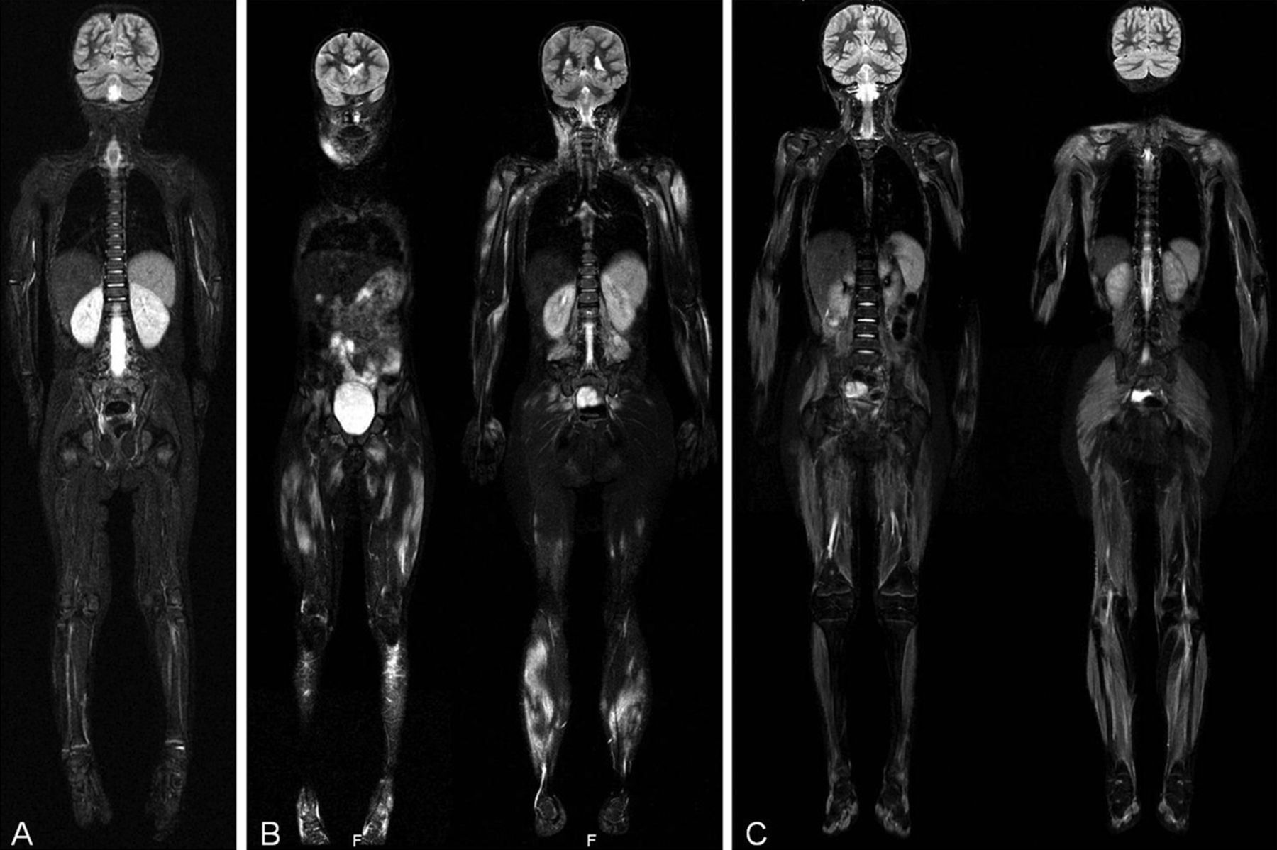 MRI in Dubai | Advanced Magnetic Resonance Imaging Services
